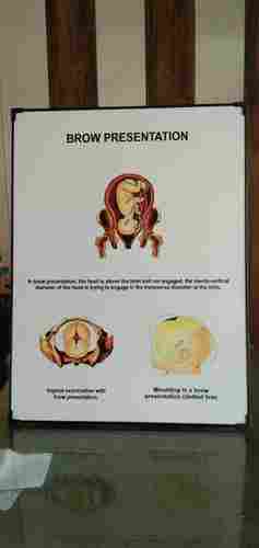 Chart Of Brow Presentation at Best Price in Ambala Cantt | R. K. Bhasin ...